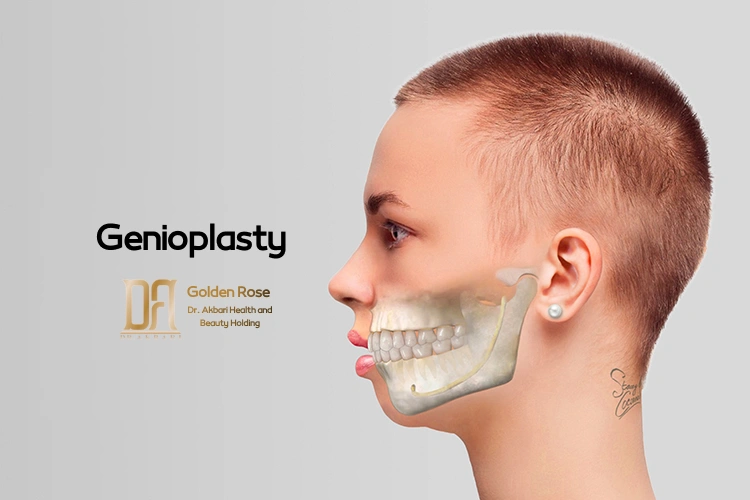 Genioplasty In Iran Turkey Chin Surgery For A Balanced Facial Profile