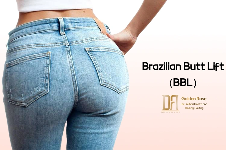 Brazilian Butt Lift (BBL) in Tehran & Istanbul 🍑 | Dr. Akbari Luxury Clinic